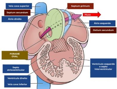Sintomas da Comunicação Interatrial: saiba mais! - Medway