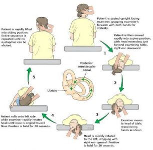 Tratamento de síndrome vestibular: saiba mais! | Medway